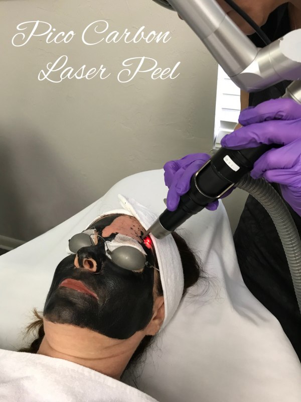 PicoSure Carbon Laser Peel in Gainesville FL | Dermacare