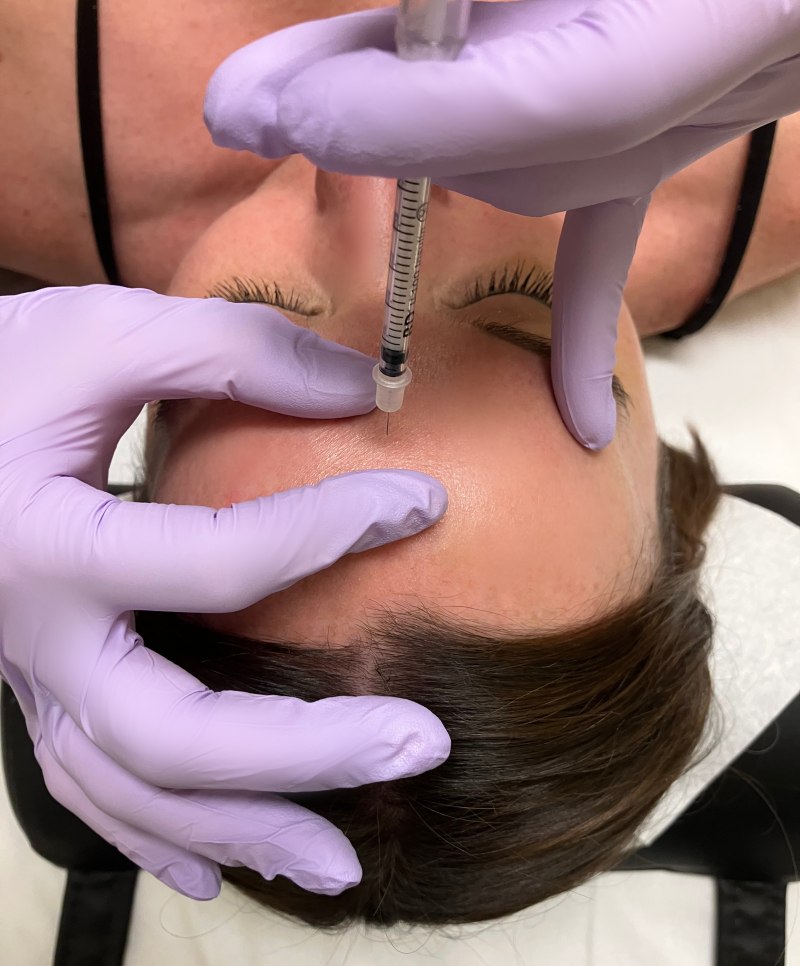BOTOX® for Wrinkles in Gainesville, Florida | Dermacare